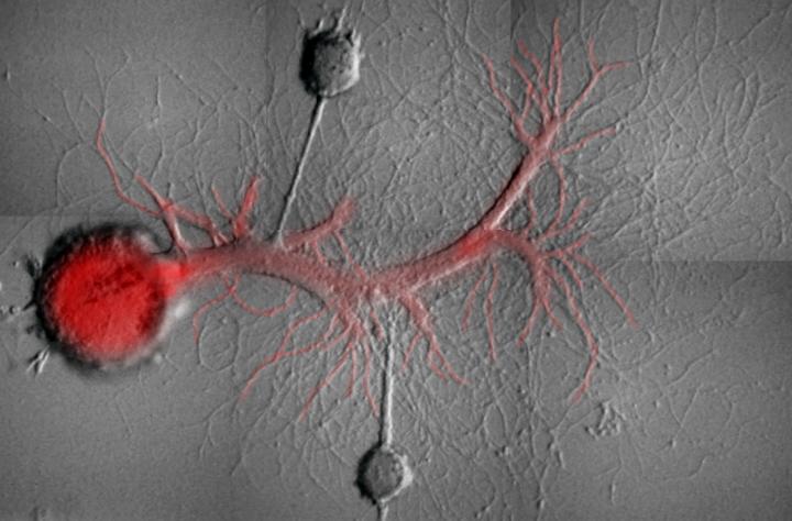 Finding a Way to Selectively Erase Memories | Cell And Molecular Biology