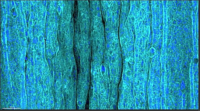 A New Wrinkle Research Model Reveals More About How They Form | Cell ...