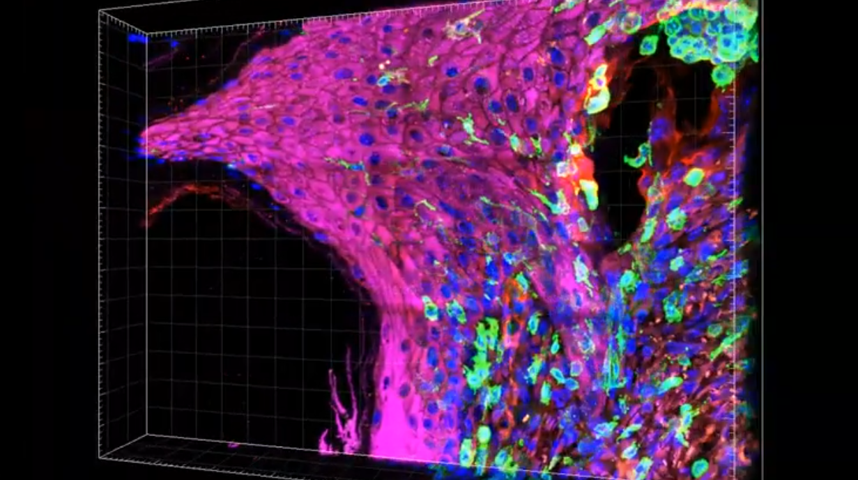 Understanding How Loose RNA molecules Help Rejuvenate Skin | Genetics ...