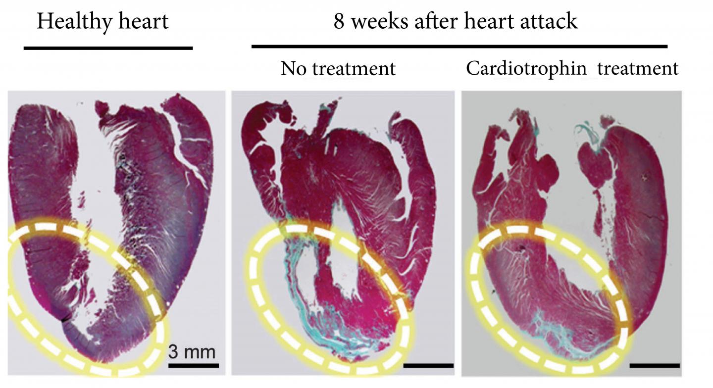Heart Protein Makes the Heart Think You're Exercising When You're Not ...