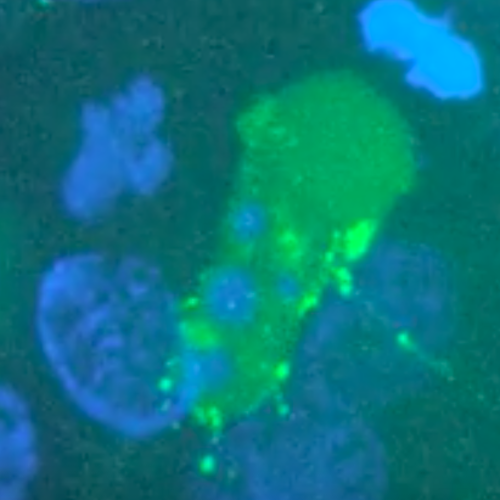 HIV Caught on Camera Infecting Cells | Cell And Molecular Biology