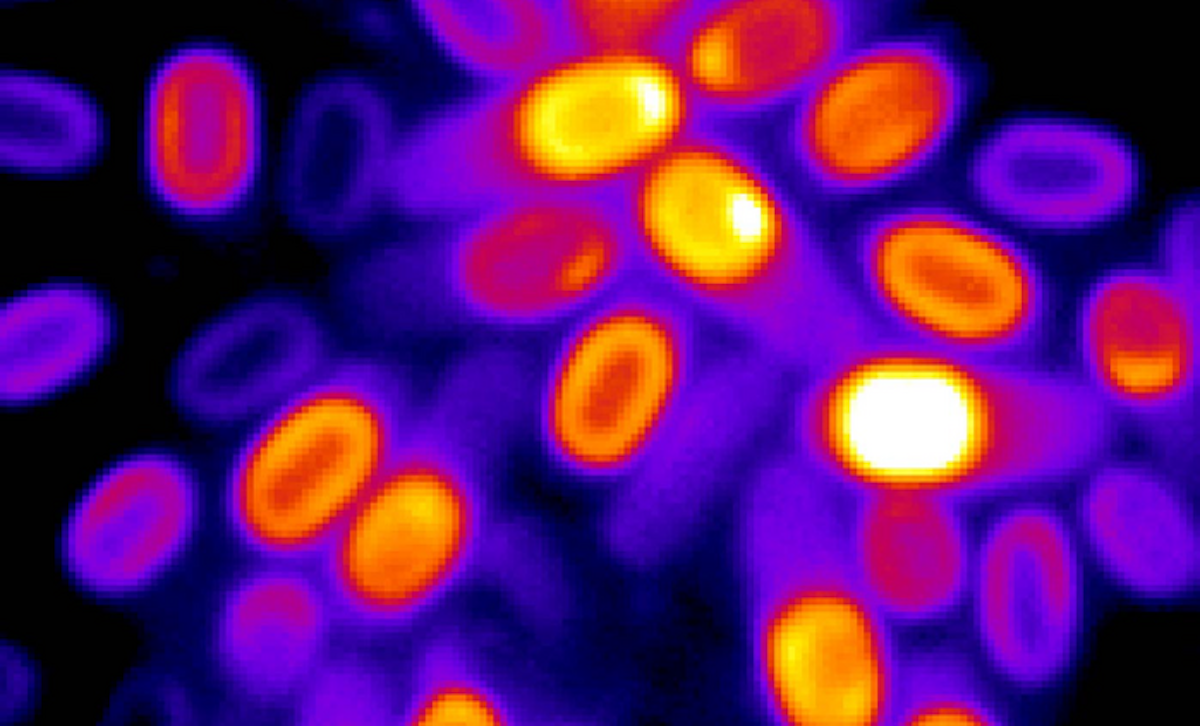 Return of the Zombie Bacteria | Cell And Molecular Biology