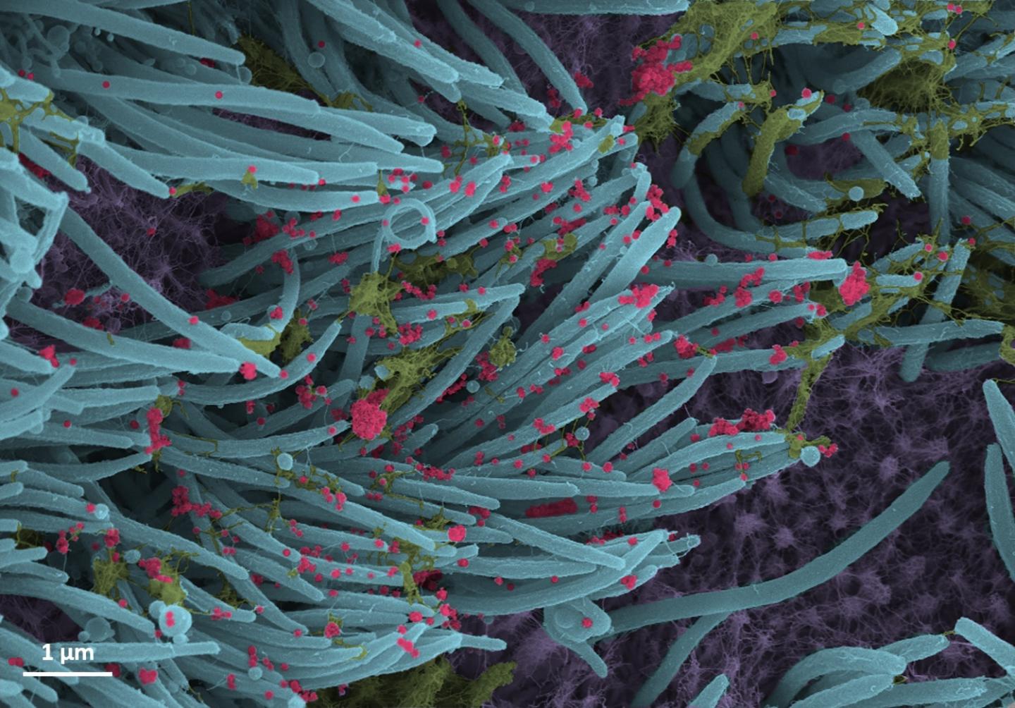 Amazing Images of the Pandemic Virus SARS-CoV-2 | Microbiology