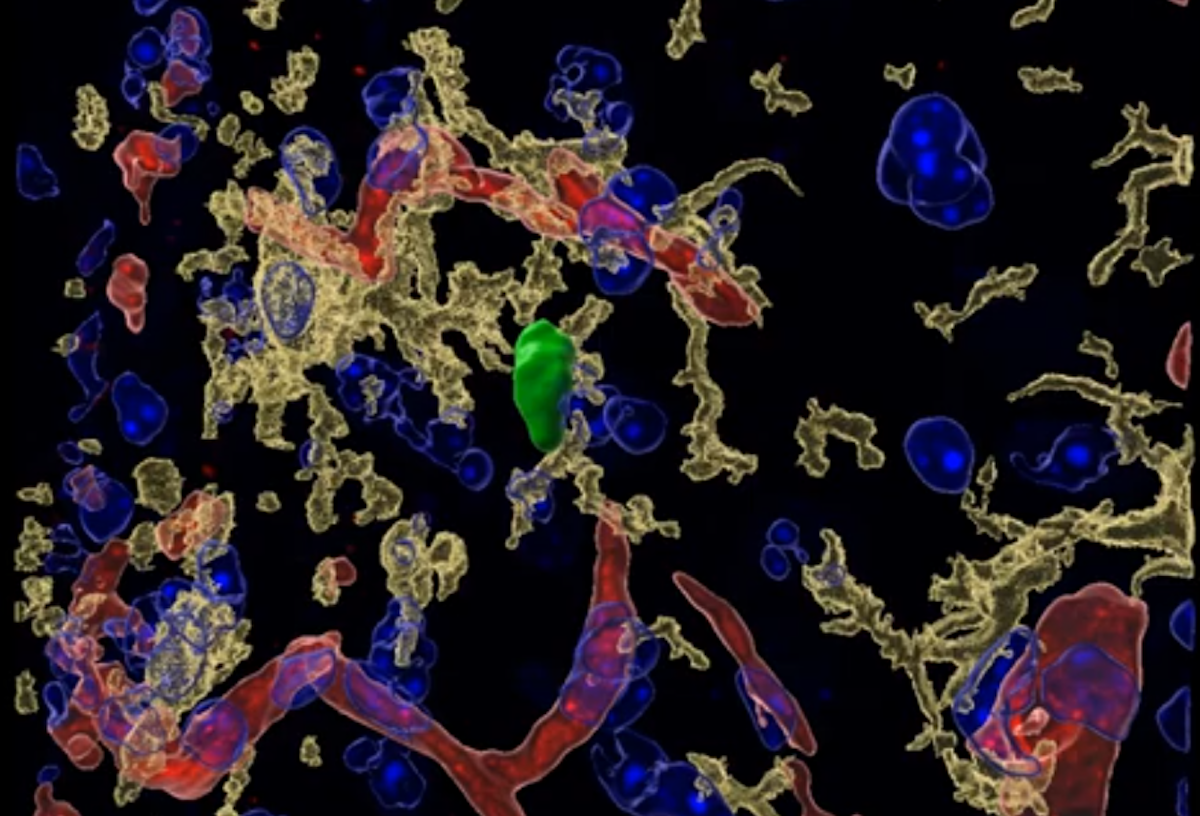 White Blood Cells Are Essential to the Developing Brain | Cell And ...