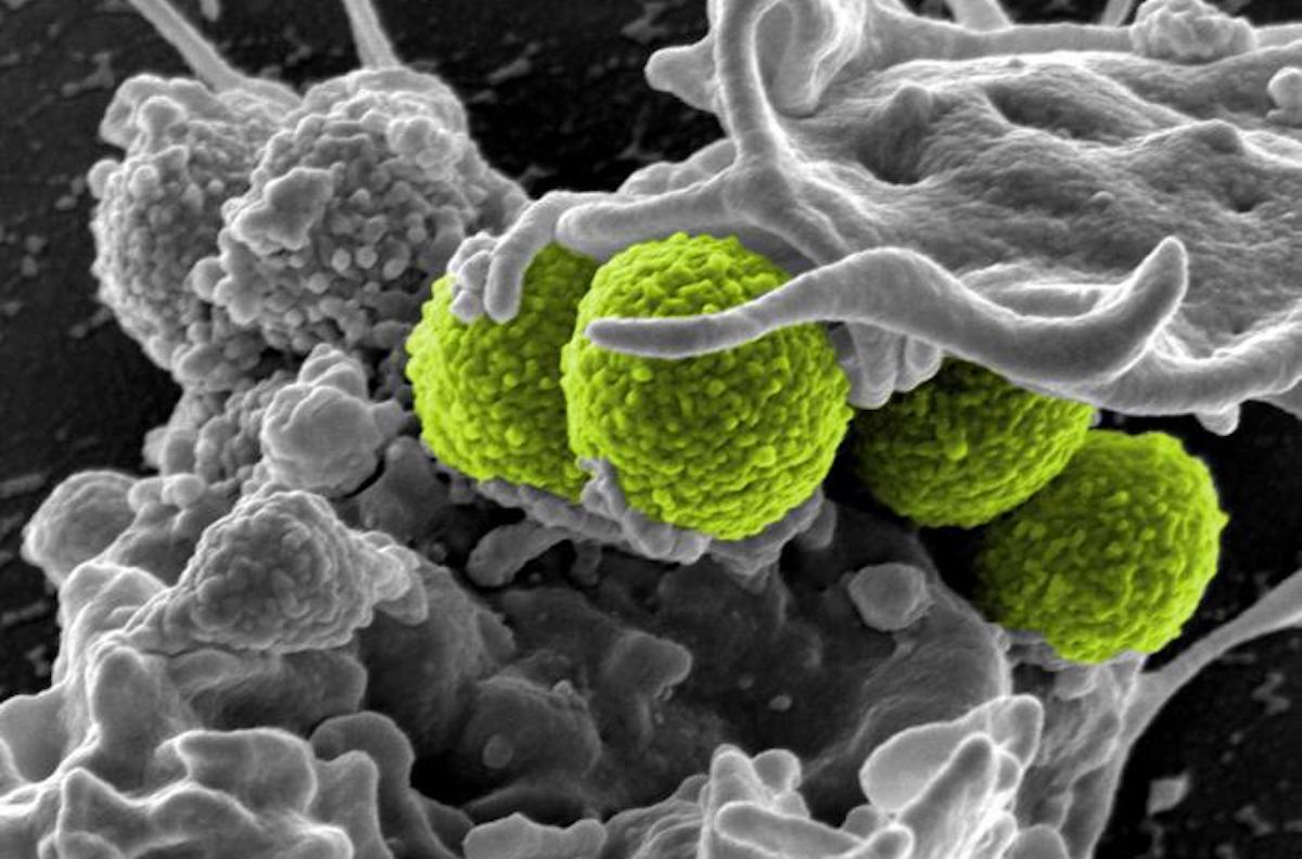 Long Before Antibacterial Drugs, MRSA Superbug Arose in Hedgehogs ...