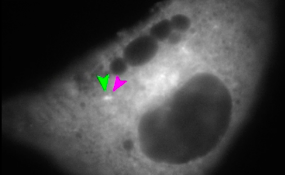 Polyomavirus Gets Into a Cell Using its Machinery | Microbiology