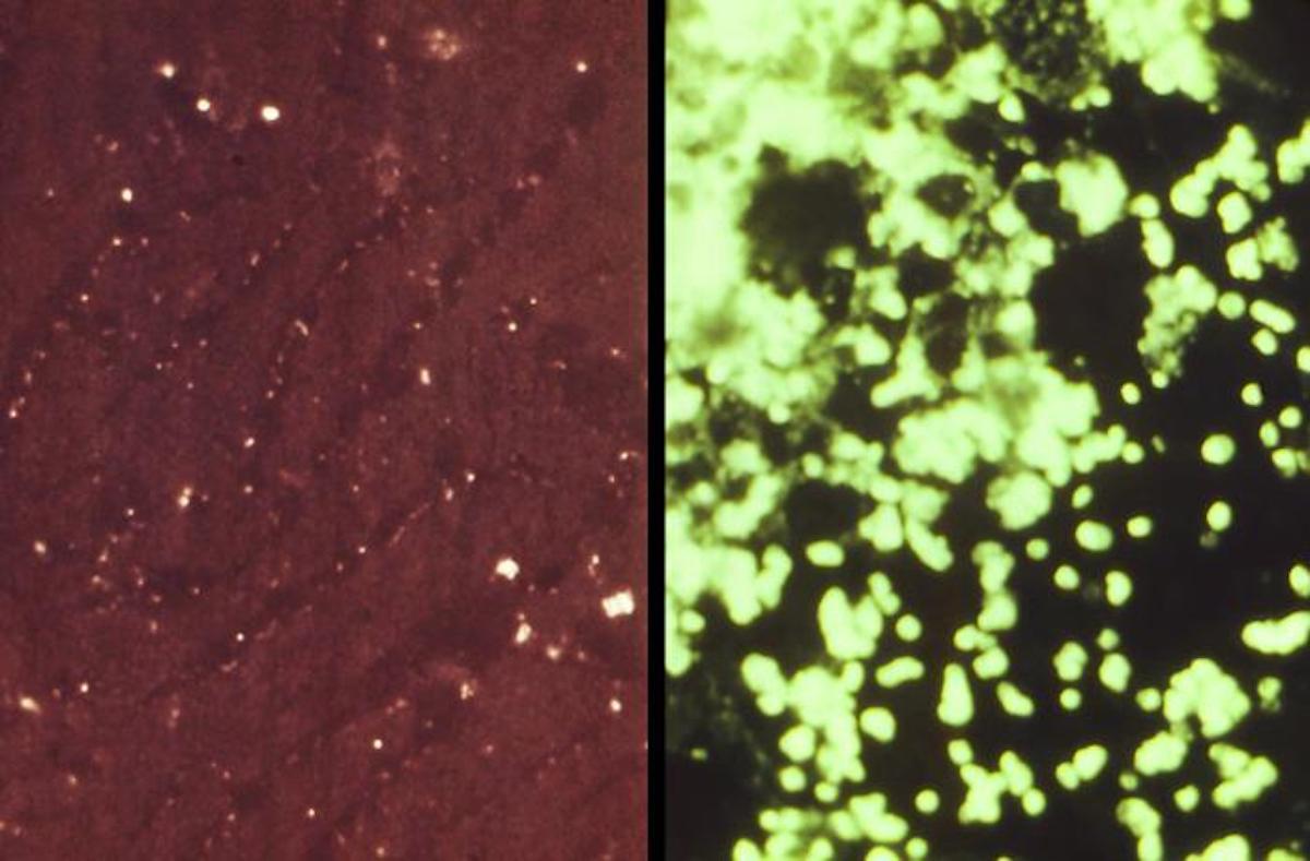 A Closer Look at a Potential Bioweapon | Microbiology