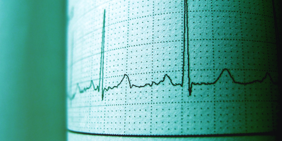 Robotic Procedure for AFib Patients Done During MRI | Technology