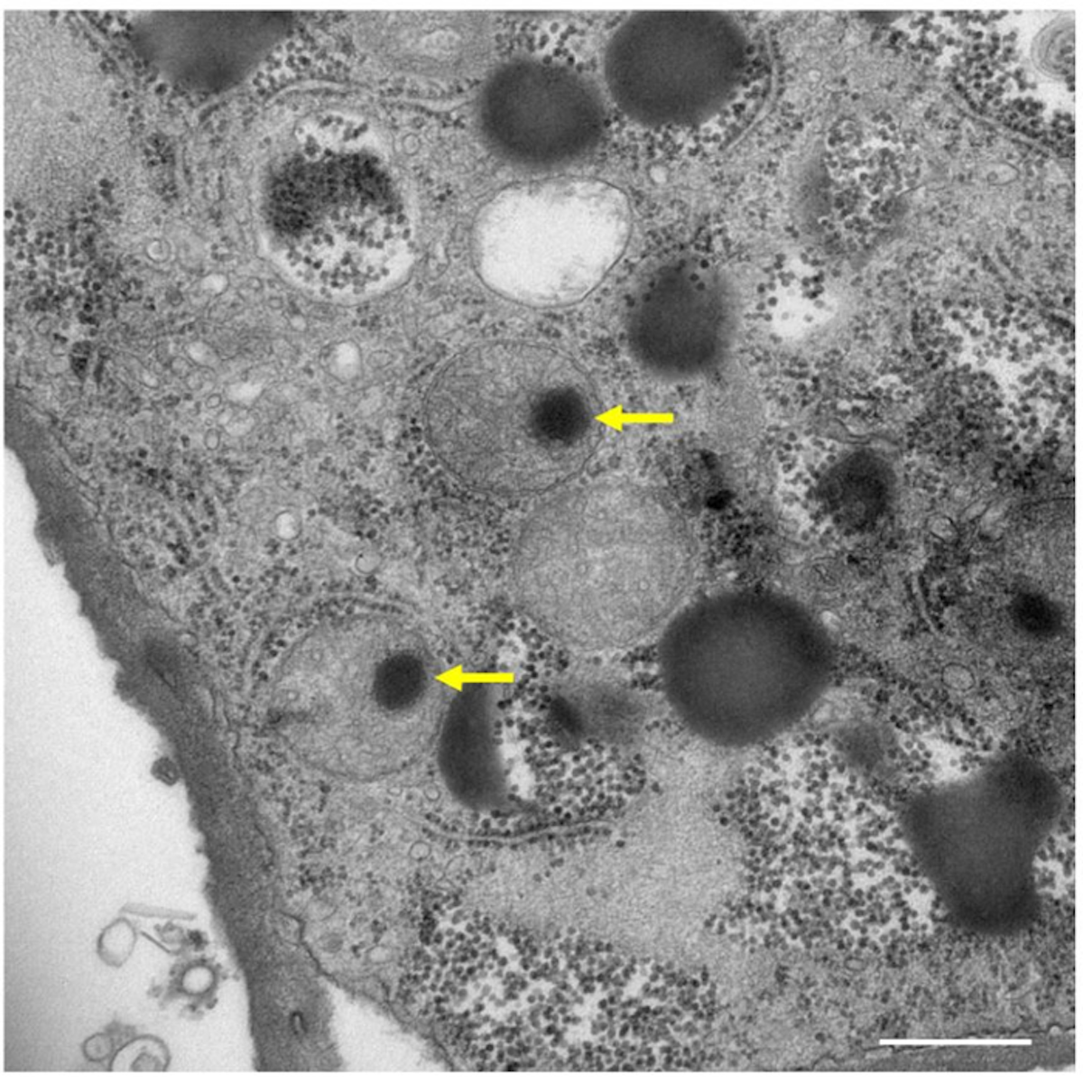 Insight Into the Maturation of Giant Viruses | Microbiology