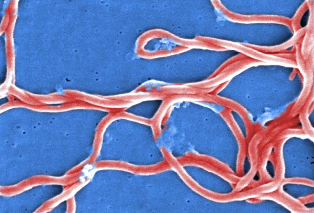 Researchers Find a Lyme Disease Treatment Target | Microbiology