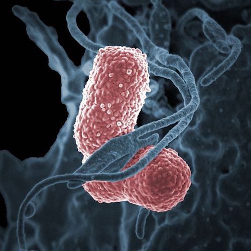 Killer Antibiotic-resistant Pathogen Isolated in the US | Microbiology