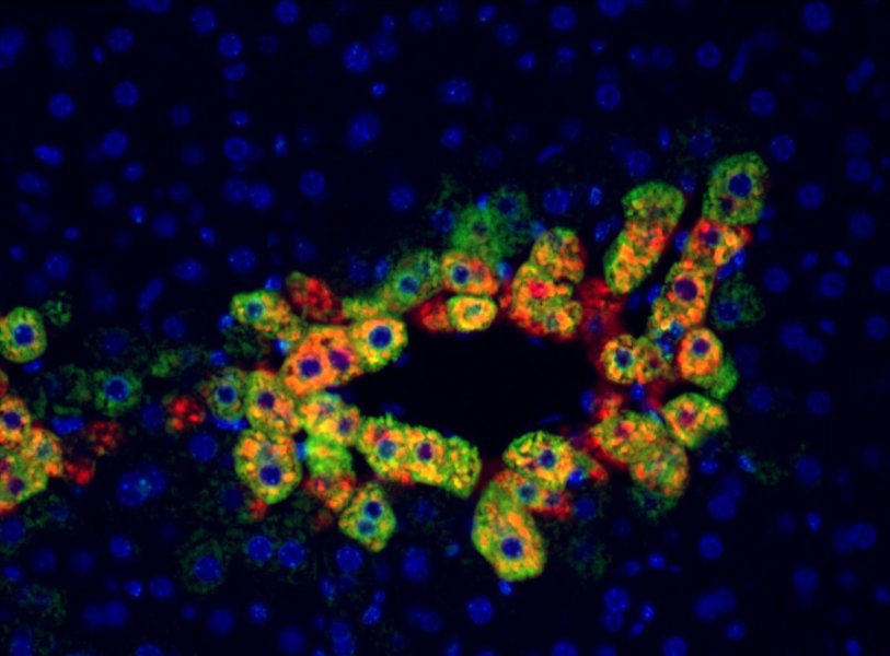 Re-purposing Anti-rejection Drug for Liver Cancers | Drug Discovery And ...