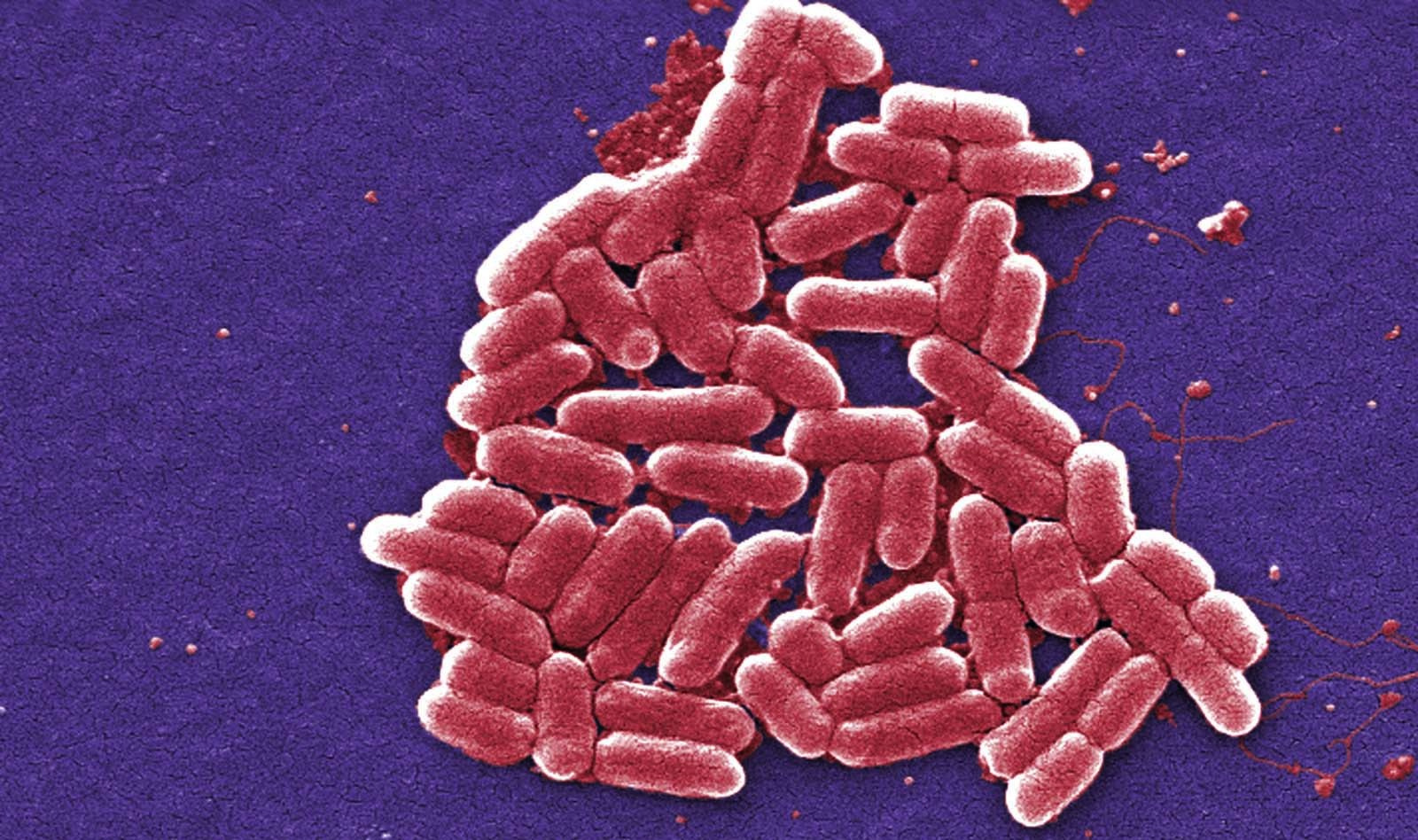 Shigella gets creative to survive the GI tract | Microbiology