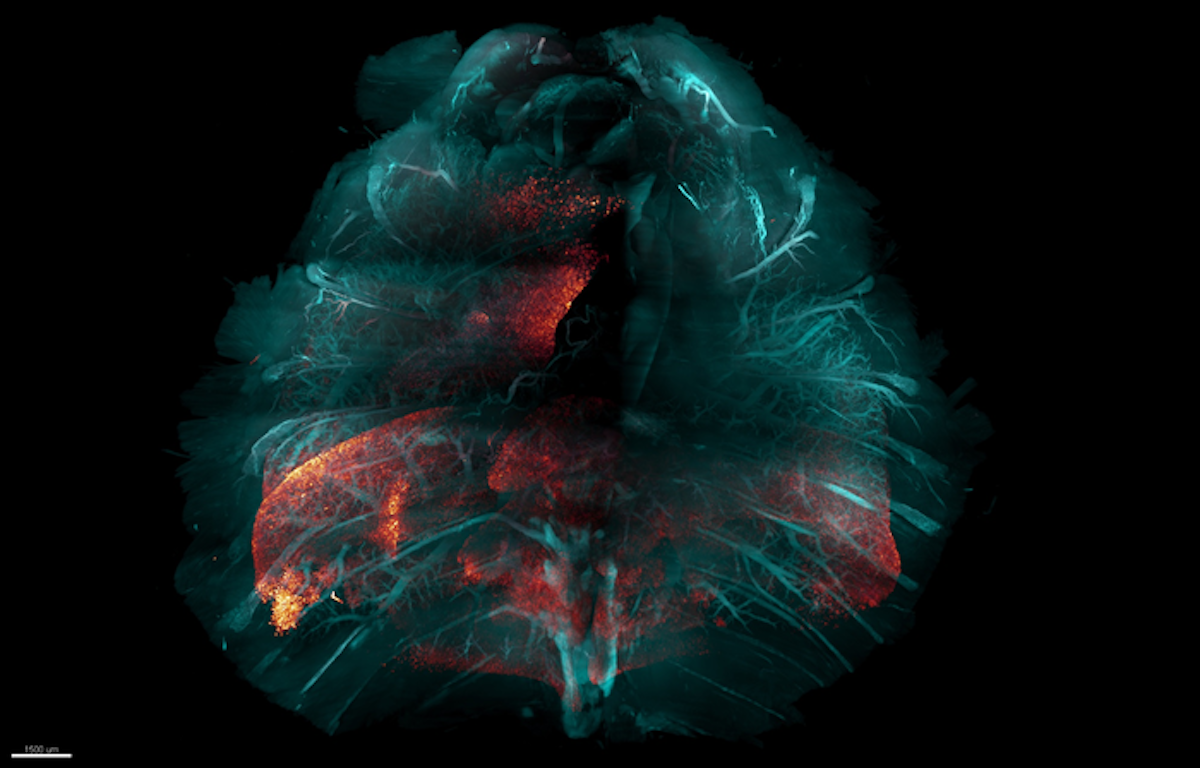 This Simple Technique Renders Big Specimens Transparent | Cell And ...