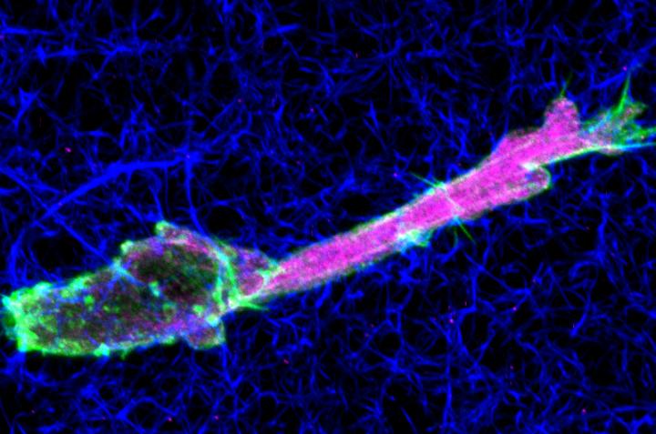 Tumor Cells Move Through Tissue in a Unique Way | Cell And Molecular ...
