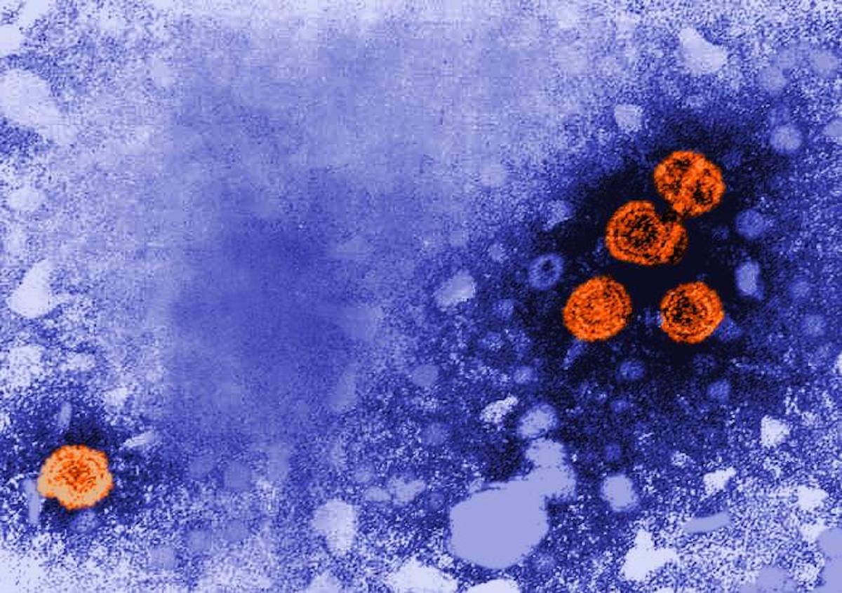 Viral Infection Can Have a Lasting Impact on Cells | Cell And Molecular ...