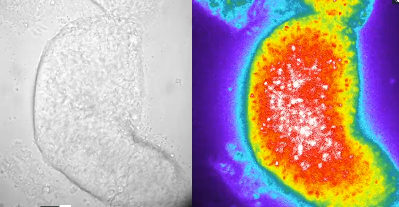 A Human Developmental Clock in a Dish | Genetics And Genomics