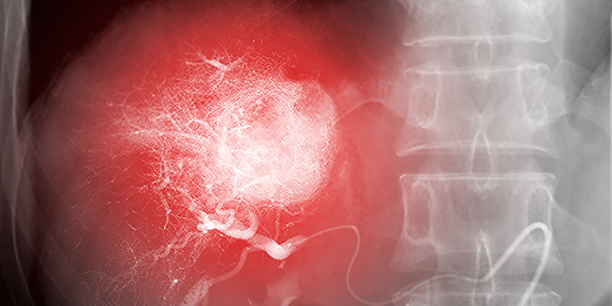 Optical Imaging in Tissue with Near-Infrared Dyes | Cell And Molecular ...