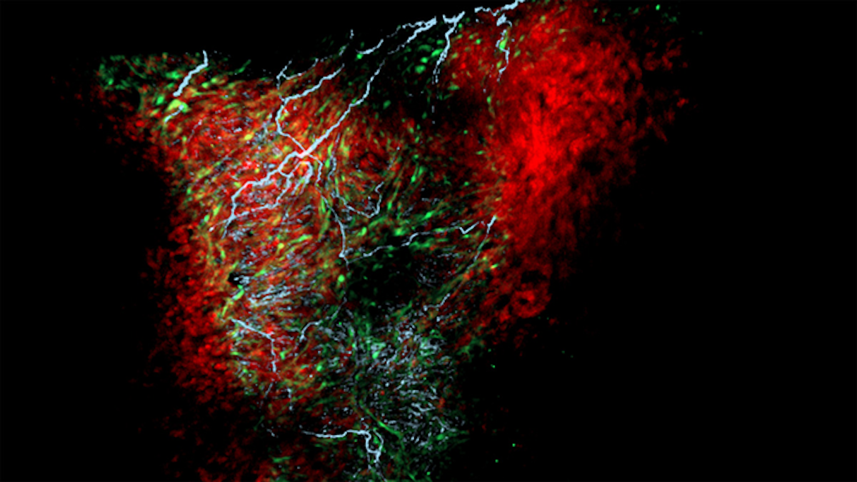 A New Type of Heart Cell is Identified | Cardiology