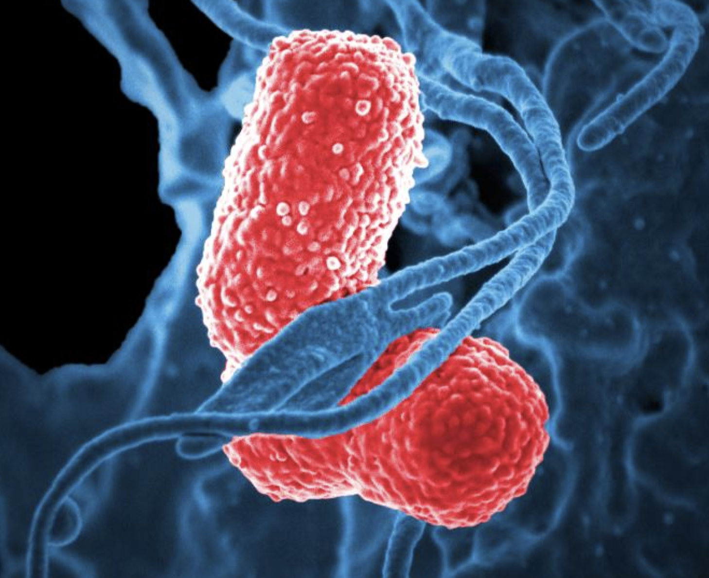 A Hospital Germ Moves Into Communities | Microbiology