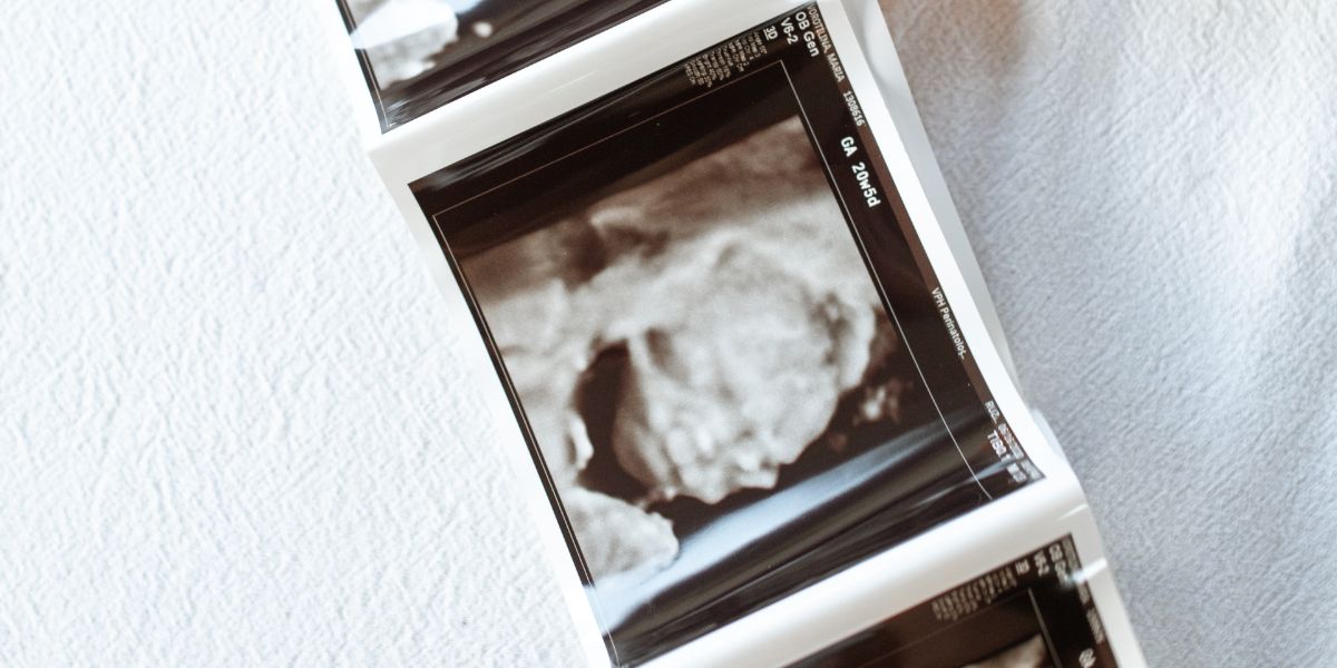 Prenatal Ultrasound Detects Early Signs of Autism | Neuroscience