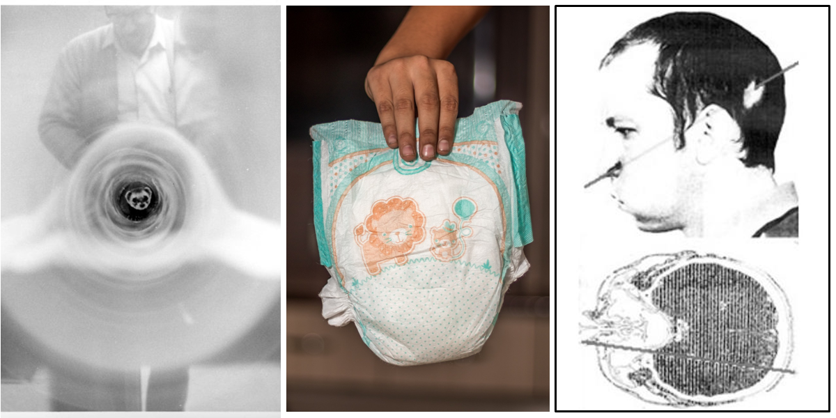 Ferret, Diaper, and Human Flesh--Odd Things that Ended Up in a Particle ...