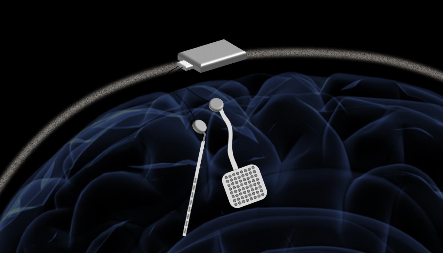 Wireless 128 channel closed loop brain stimulation device | Health And ...