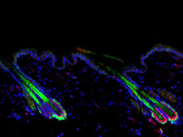 Molecule Sways Stem Cell Plasticity by Boosting | Cell And Molecular ...