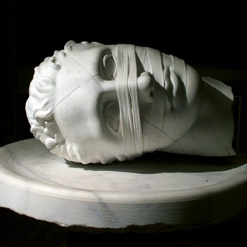 Migraine Surgery Yields Results For Many Patients | Health And Medicine