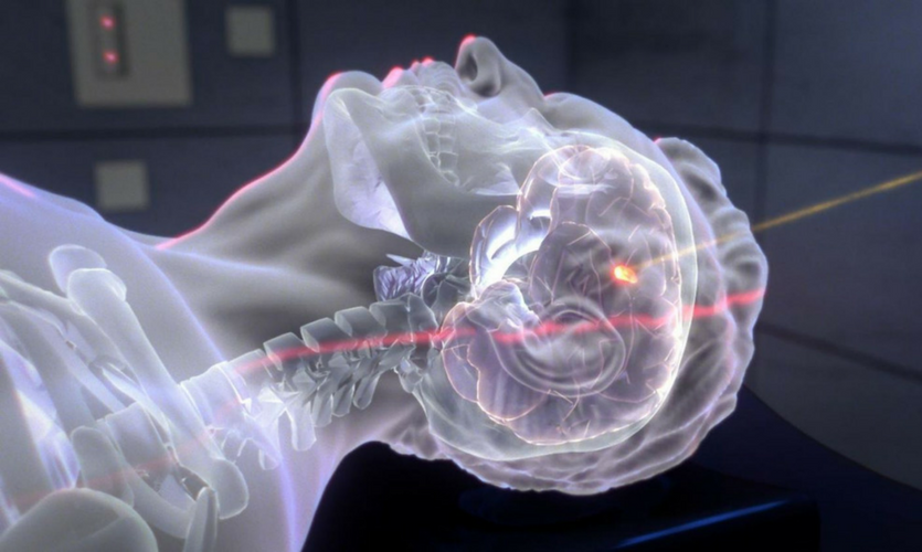 Imagine Your Head, In a Particle Accelerator | Chemistry And Physics