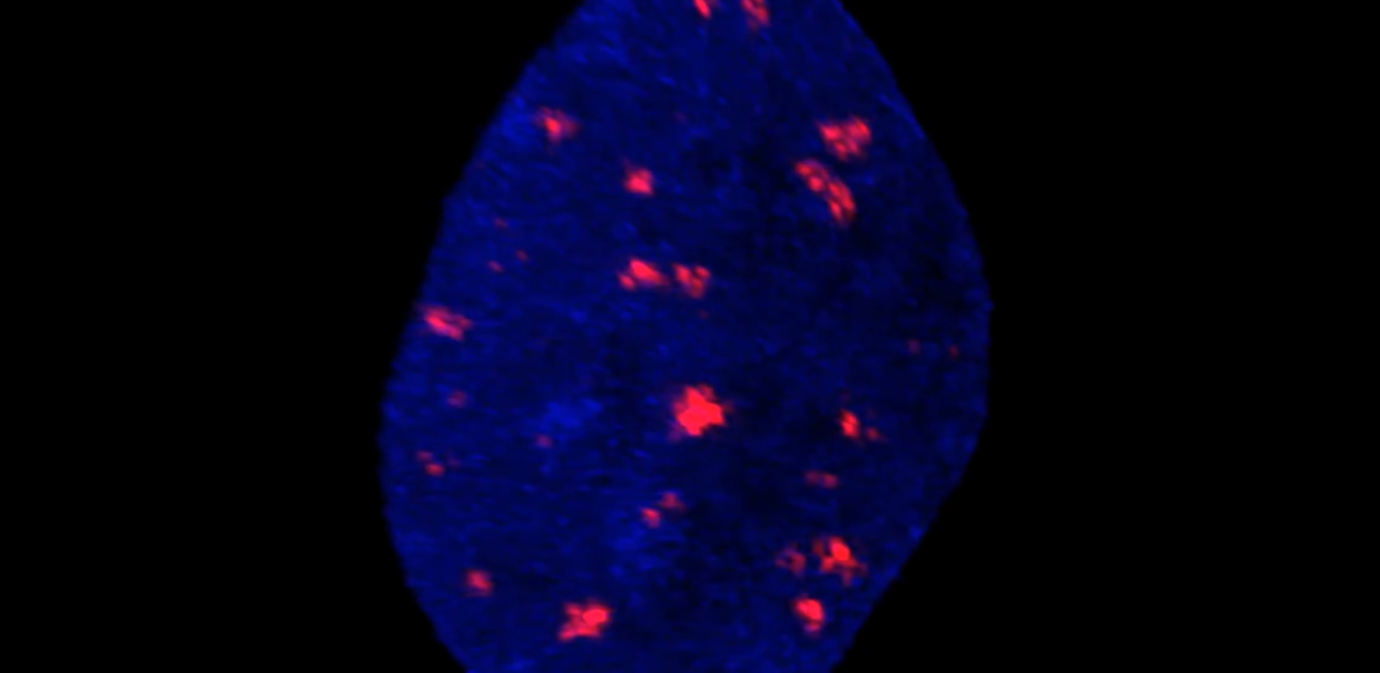 Super-Resolution Microscopy Reveals How DNA Damage is Repaired ...