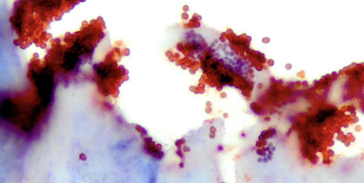 How Stem Cells May Aid in the Treatment of MRSA | Cell And Molecular ...