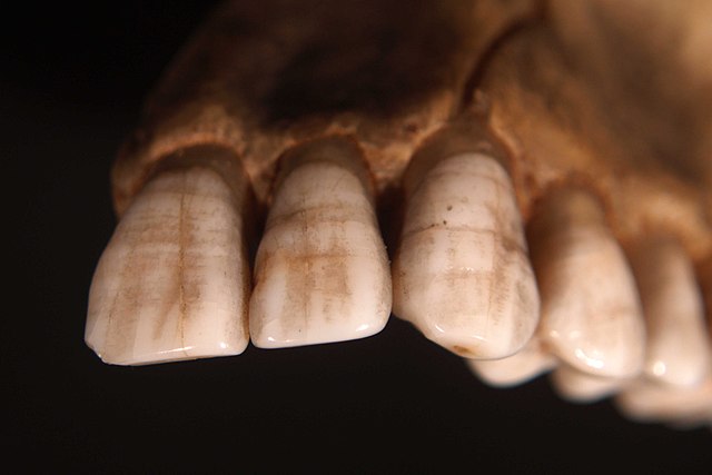Teeth record life's stressful events in primates | Plants And Animals