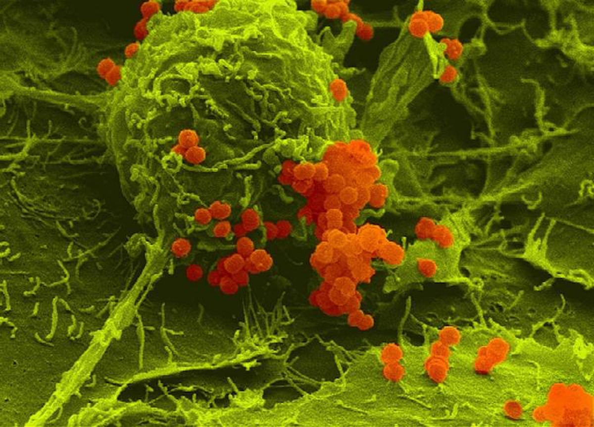 The Big Effect of a Small Protein | Microbiology