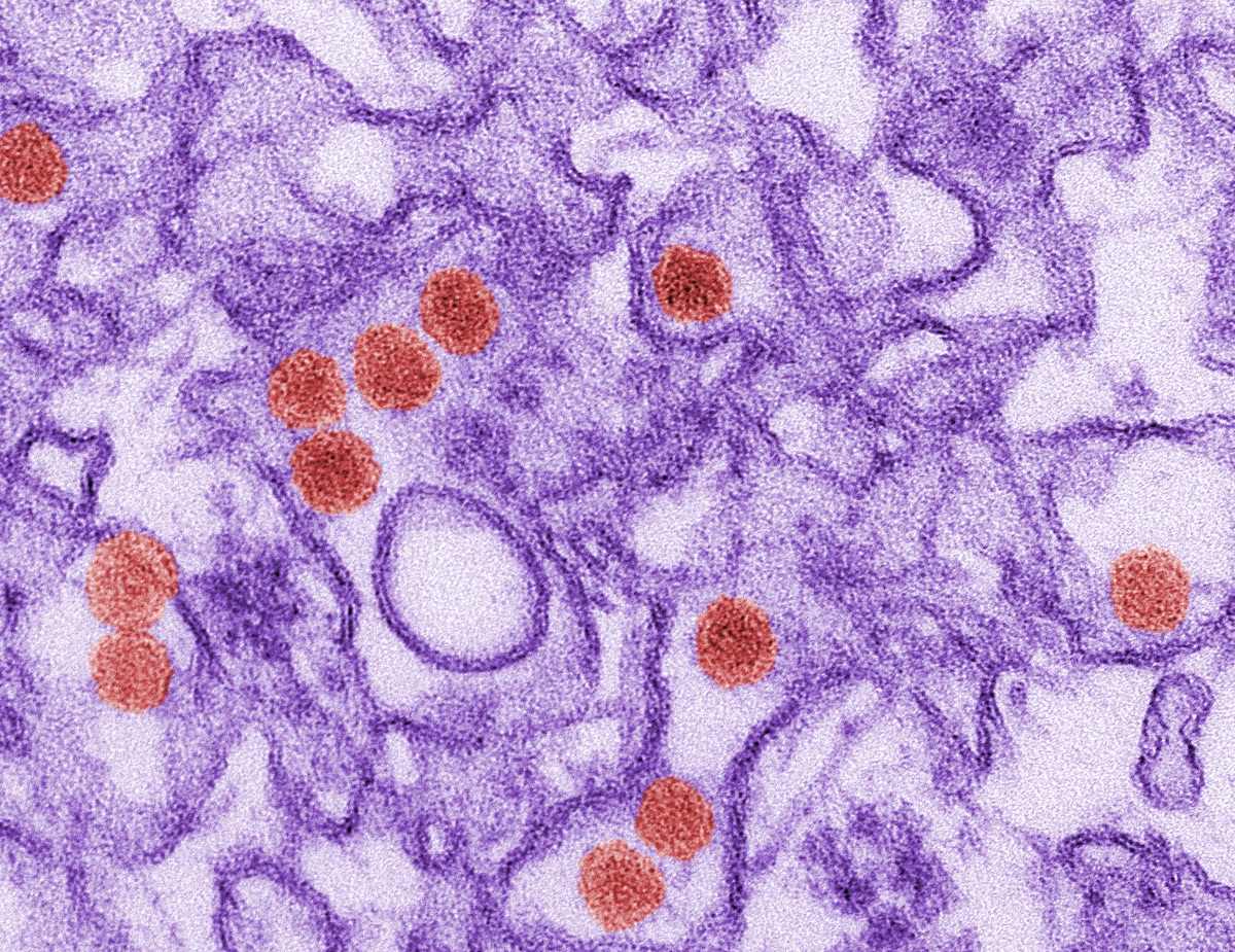 A New Way to Detect Any Human Virus | Microbiology