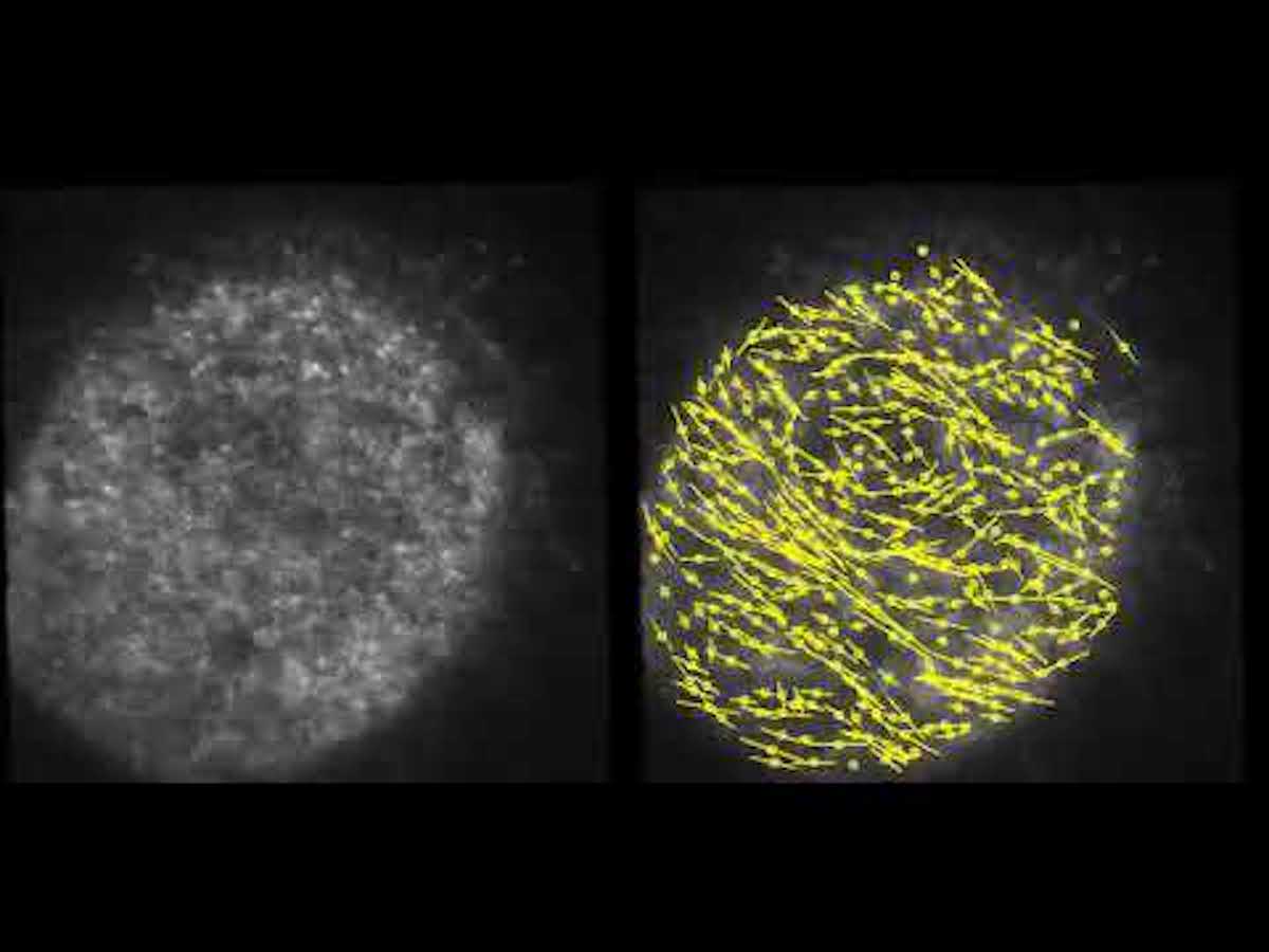 Watching the Body Plan Emerge | Cell And Molecular Biology