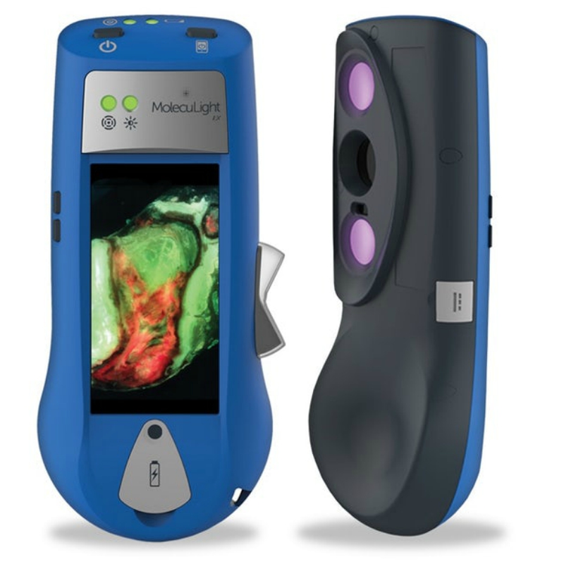MolecuLight i:X Quickly Detects Bacteria in Wounds | Technology