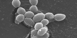 Researchers Surprised to Find Bacteria That Make Electricity in the ...