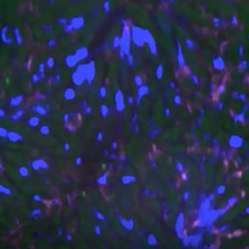 Revealing why Sepsis Causes Organs to Fail | Microbiology