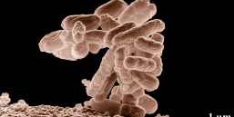 Identifying Microbes That can Generate Electricity | Microbiology
