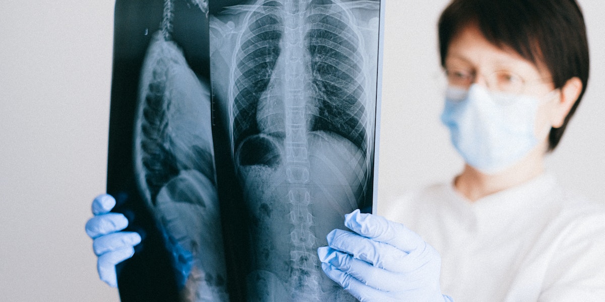 Lab-Created Mini Lungs to Study Infections | Technology