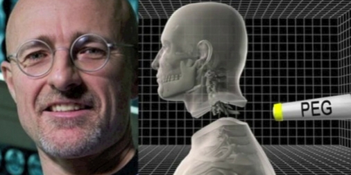 First 'Successful' Head Transplant Controversy | Clinical And Molecular Dx