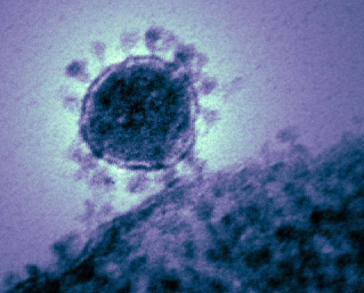 Is Coronavirus Spillover More Common Than We Knew? | Microbiology