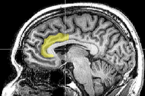 Virtual Reality Simulations For Stroke Recovery | Neuroscience