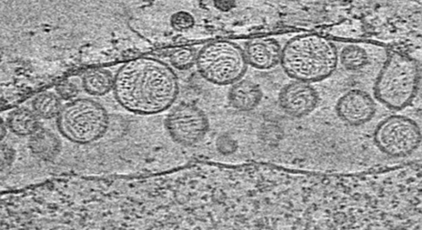 Getting a Close Look at Viral Replication | Microbiology