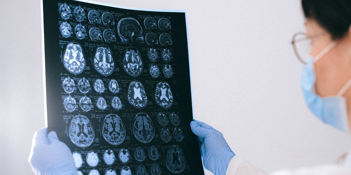 Common Hormone Drug Increases Risk of Benign Brain Tumors | Drug ...