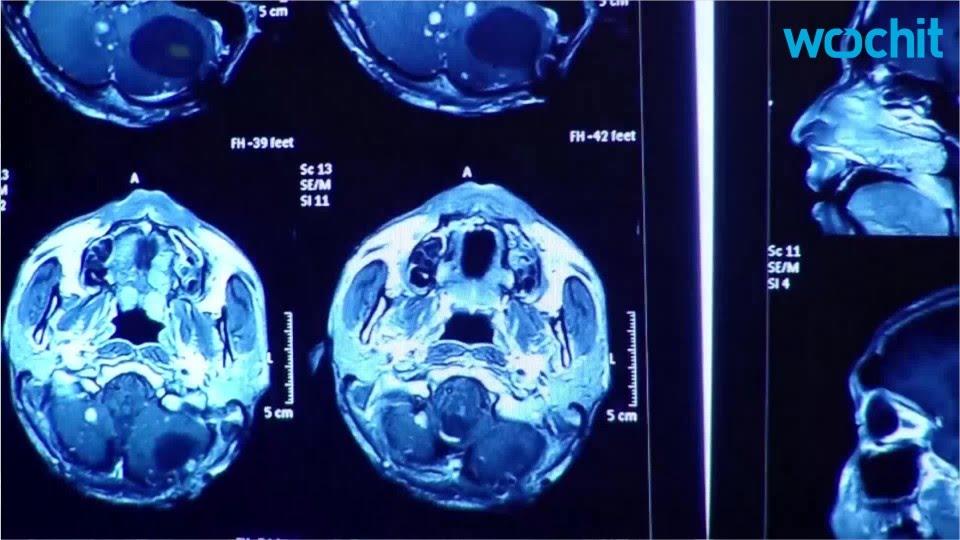 The Hypnotized Brain Looks Different to Neurobiologists | Videos