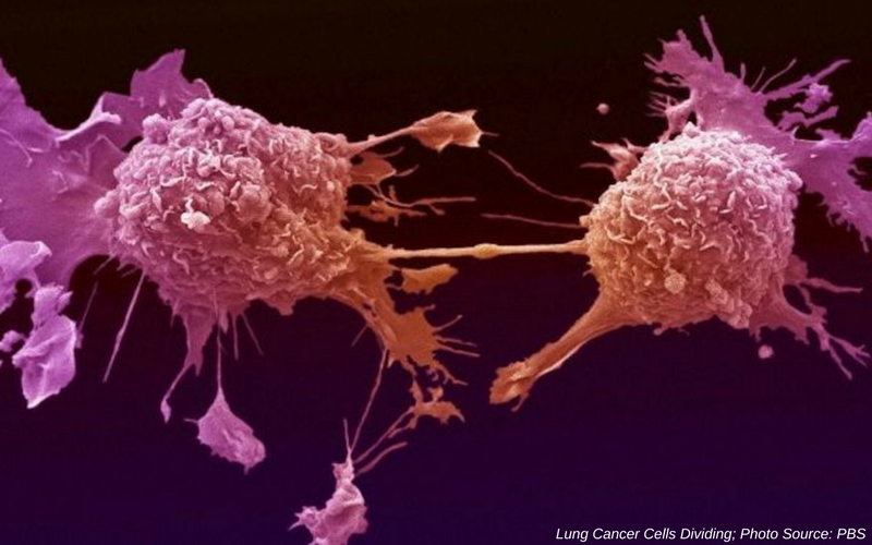 Stem Cell and Cancer Cell Studies Similarities and Differences Creating ...