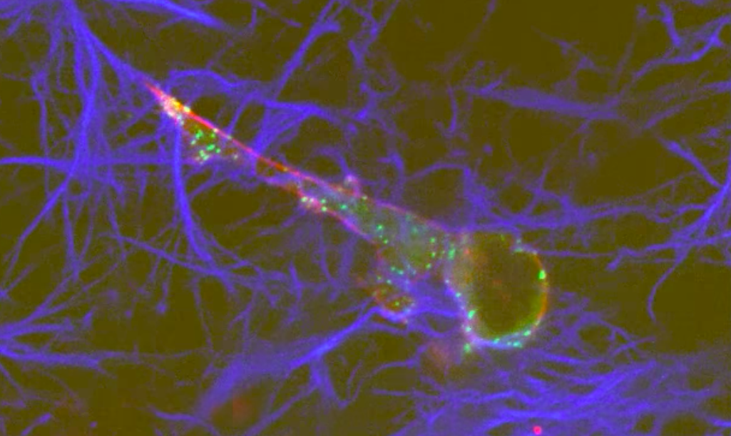 New Mechanism of Cancer Cell Migration Discovered | Cell And Molecular ...