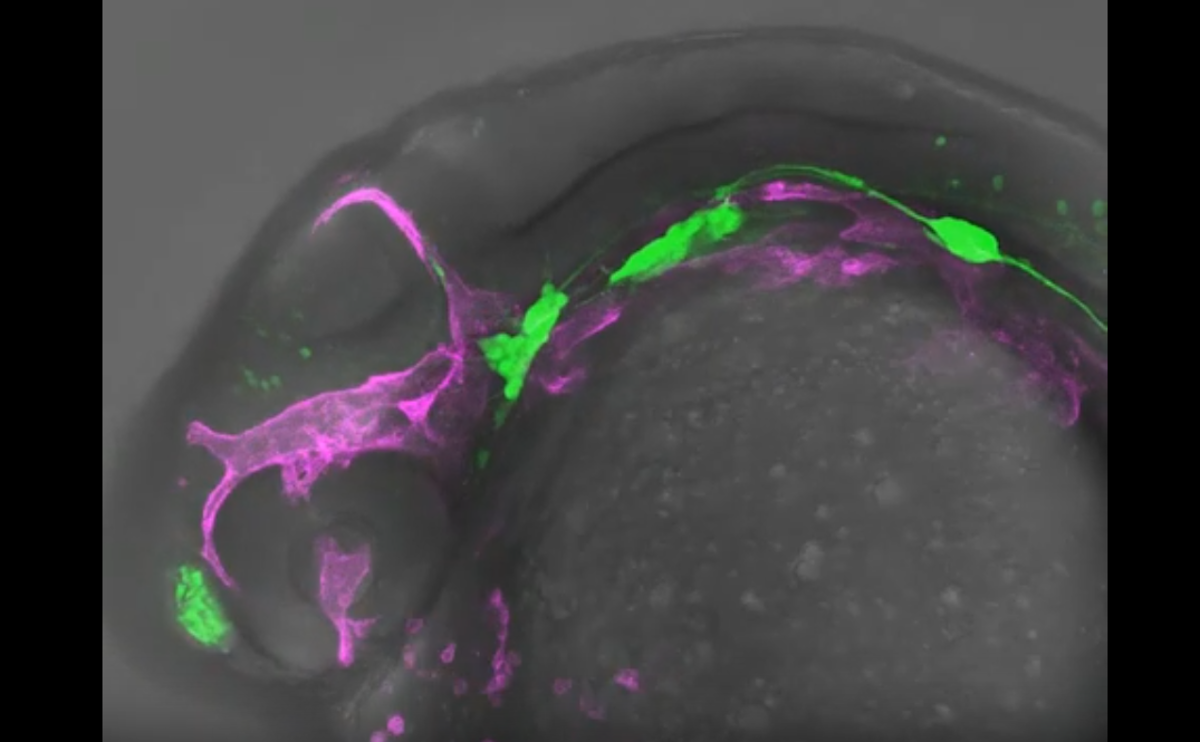 Neurons and Blood Vessels 'Talk' About Cell Fate | Cell And Molecular ...